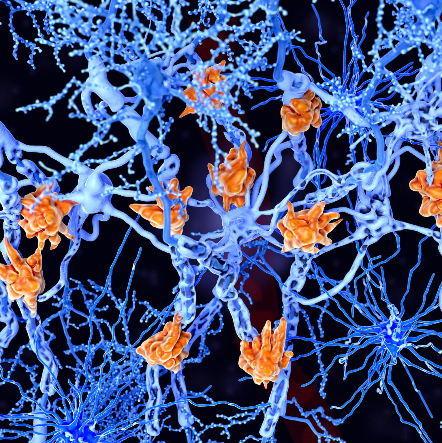 Inflammation & Autoimmune Disease Models | IBD, RA, EAE - WuXi Biology