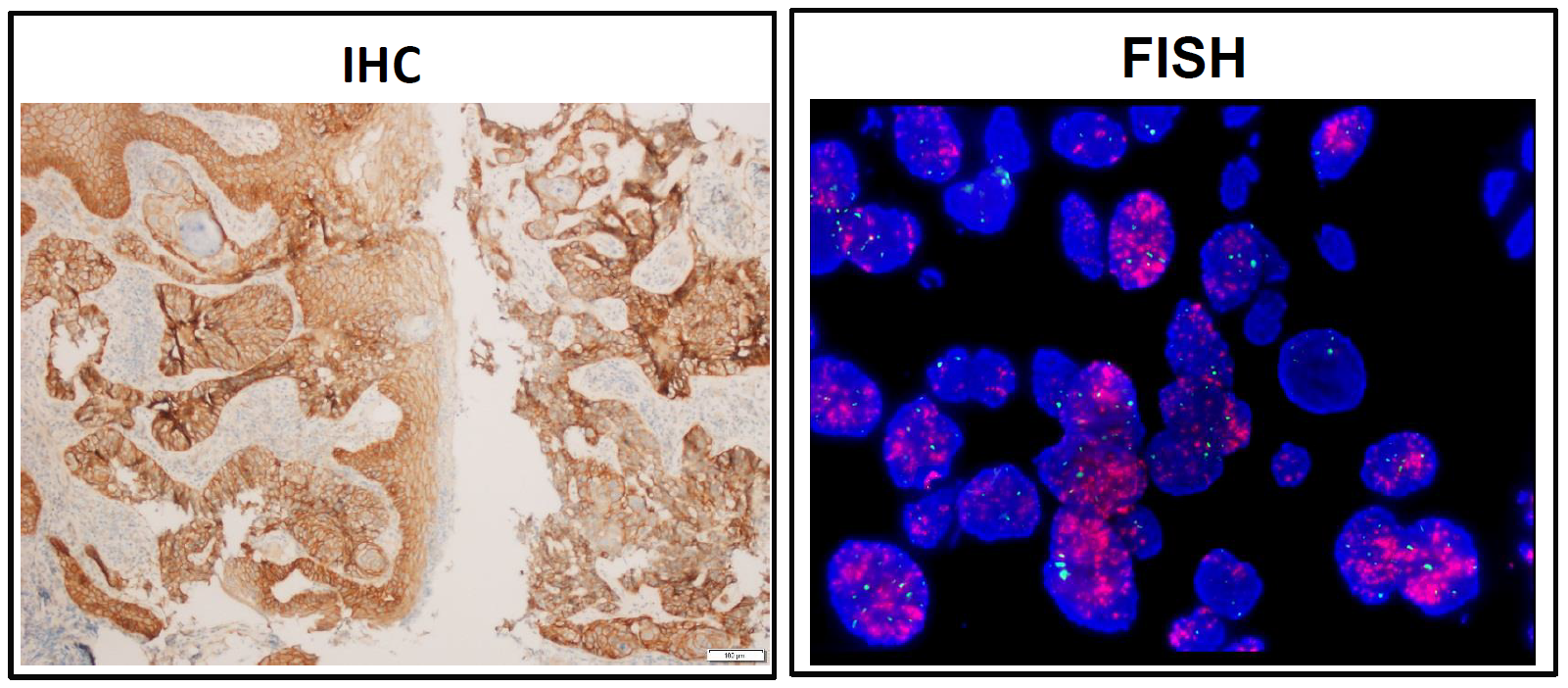 Translational Oncology - WuXi Biology