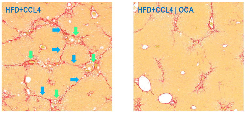 Liver Disease Models - WuXi Biology