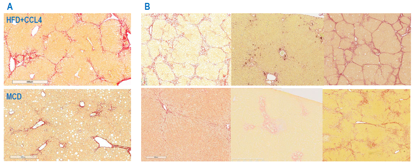 Liver Disease Models - WuXi Biology