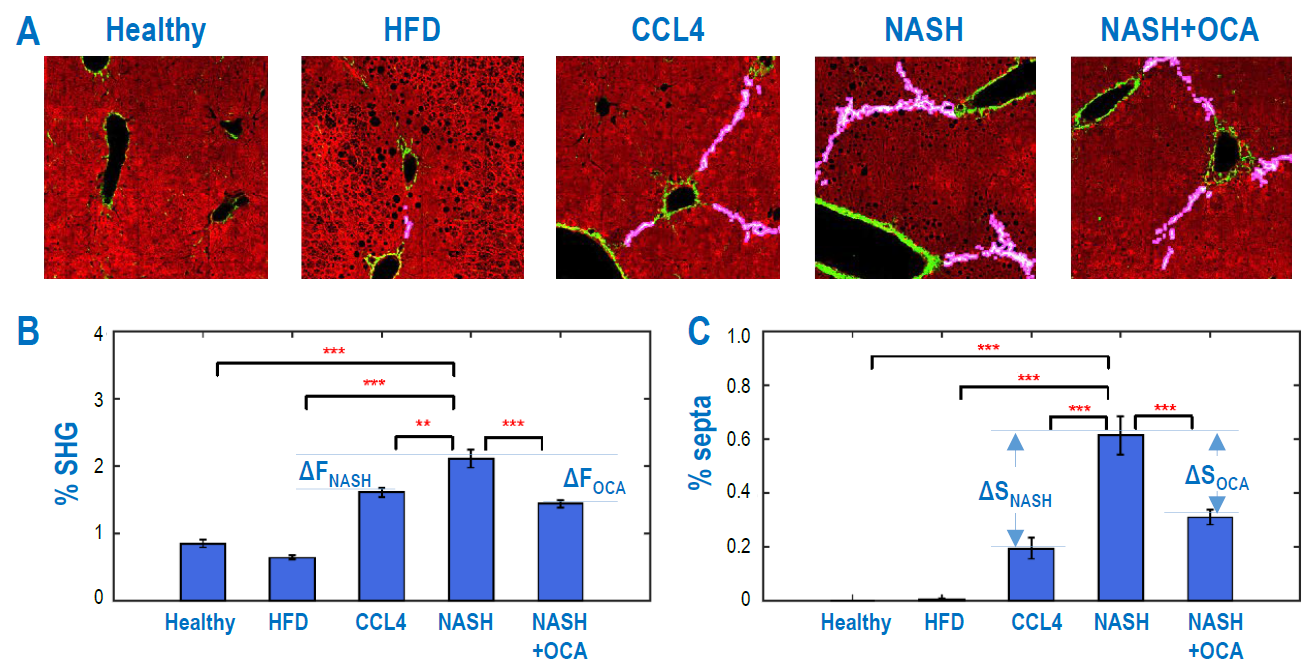 Liver Disease Models - WuXi Biology