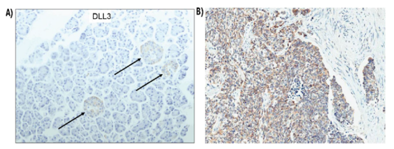 OncoWuXi Express: Efficacy of DLL3 CAR-T in SHP-77 Tumor Models - WuXi ...