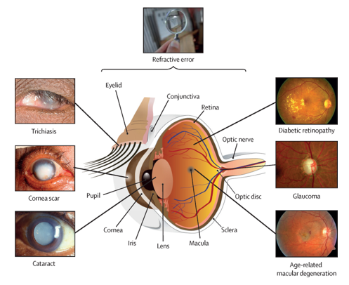 Ophthalmic Drug Development & In Vivo Models - WuXi Biology