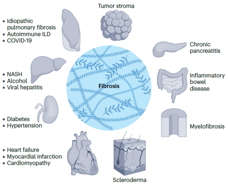 Fibrosis Drug Development & Disease Models - WuXi Biology